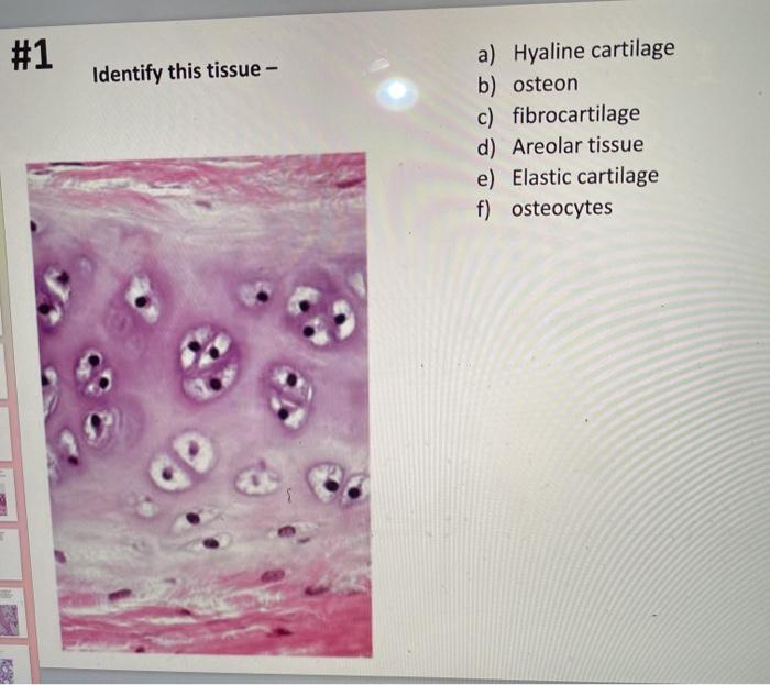 Solved #1 Identify this tissue - a) Hyaline cartilage b) | Chegg.com