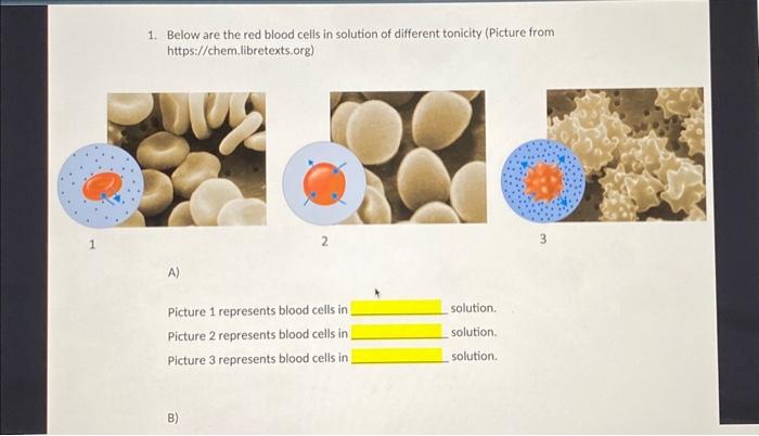 Solved 1. Below are the red blood cells in solution of | Chegg.com