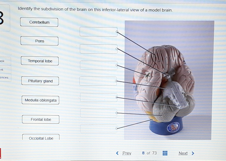 Solved identify the subdivision of the brain on this | Chegg.com