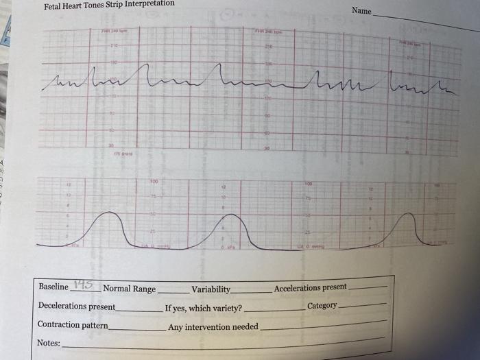 Solved Fetal Heart Tones Strip Interpretation Name 20 | Chegg.com