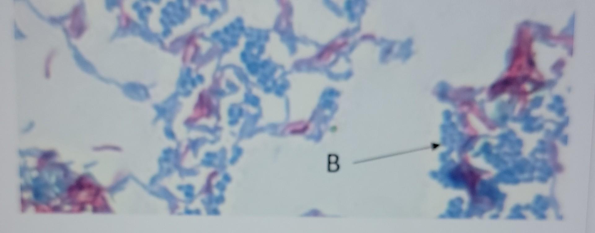 Solved 1. You are performing a acid fast stain on acid fast | Chegg.com