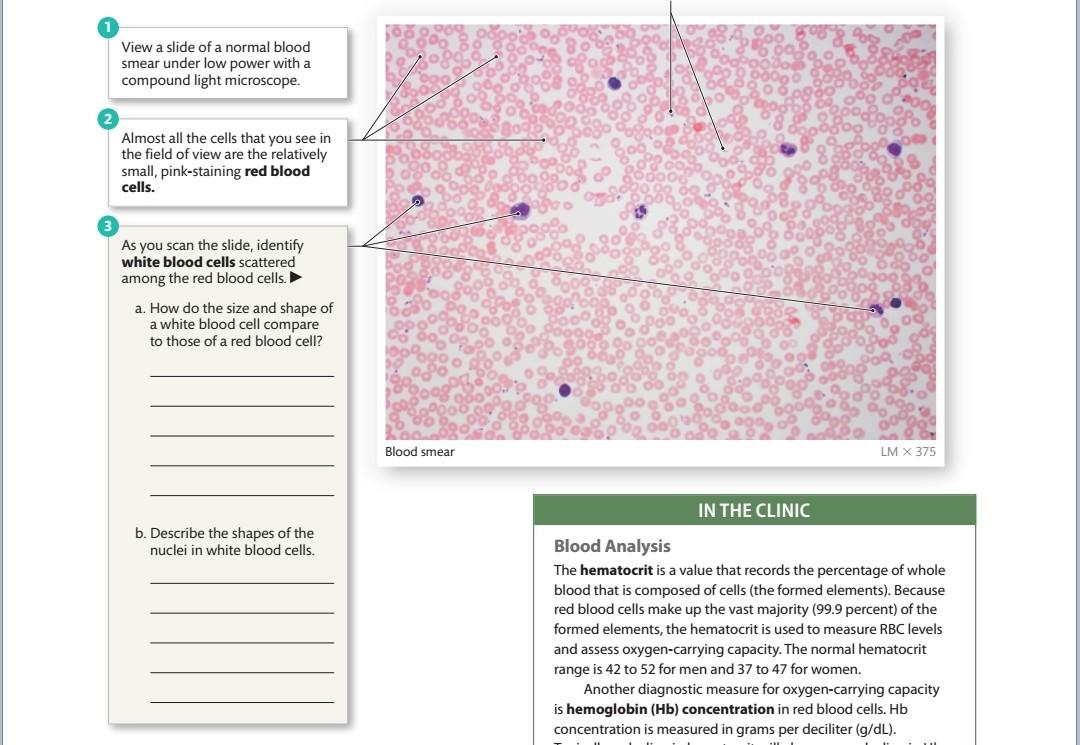 Solved View a slide of a normal blood smear under low power | Chegg.com