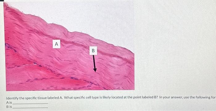 Solved Identify the specific tissue labeled A. What specific | Chegg.com