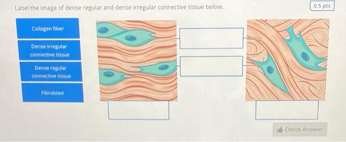 Solved Label the image of dense regular and dense irregular | Chegg.com