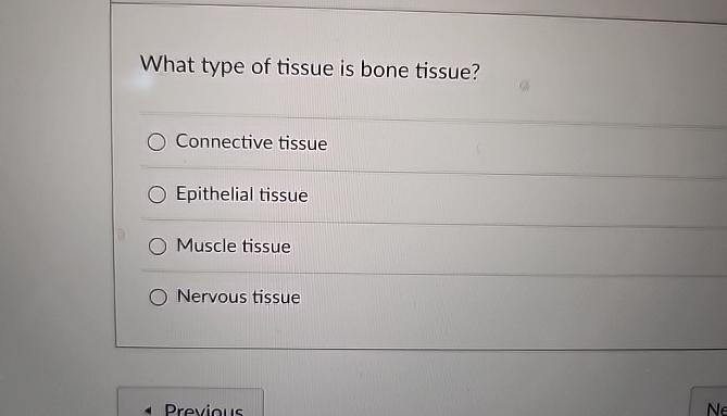 Solved What type of tissue is bone tissue?Connective | Chegg.com