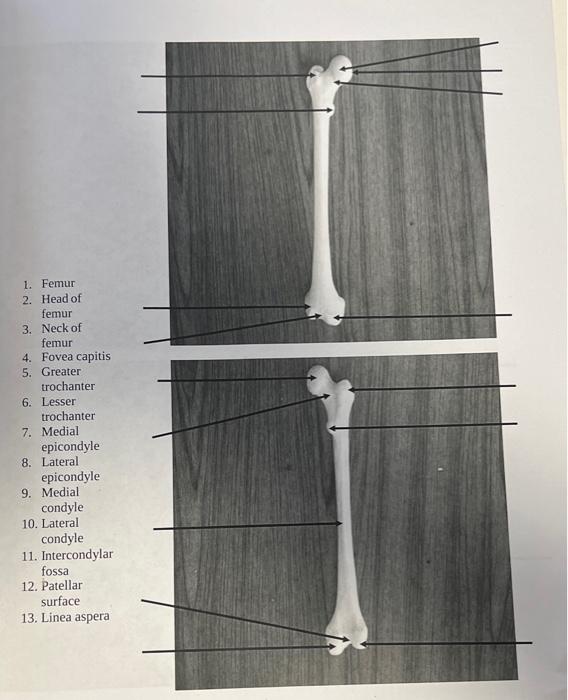 1. Femur 2. Head of femur 3. Neck of femur 4. Fovea | Chegg.com