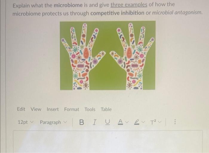 Solved Explain what the microbiome is and give three | Chegg.com