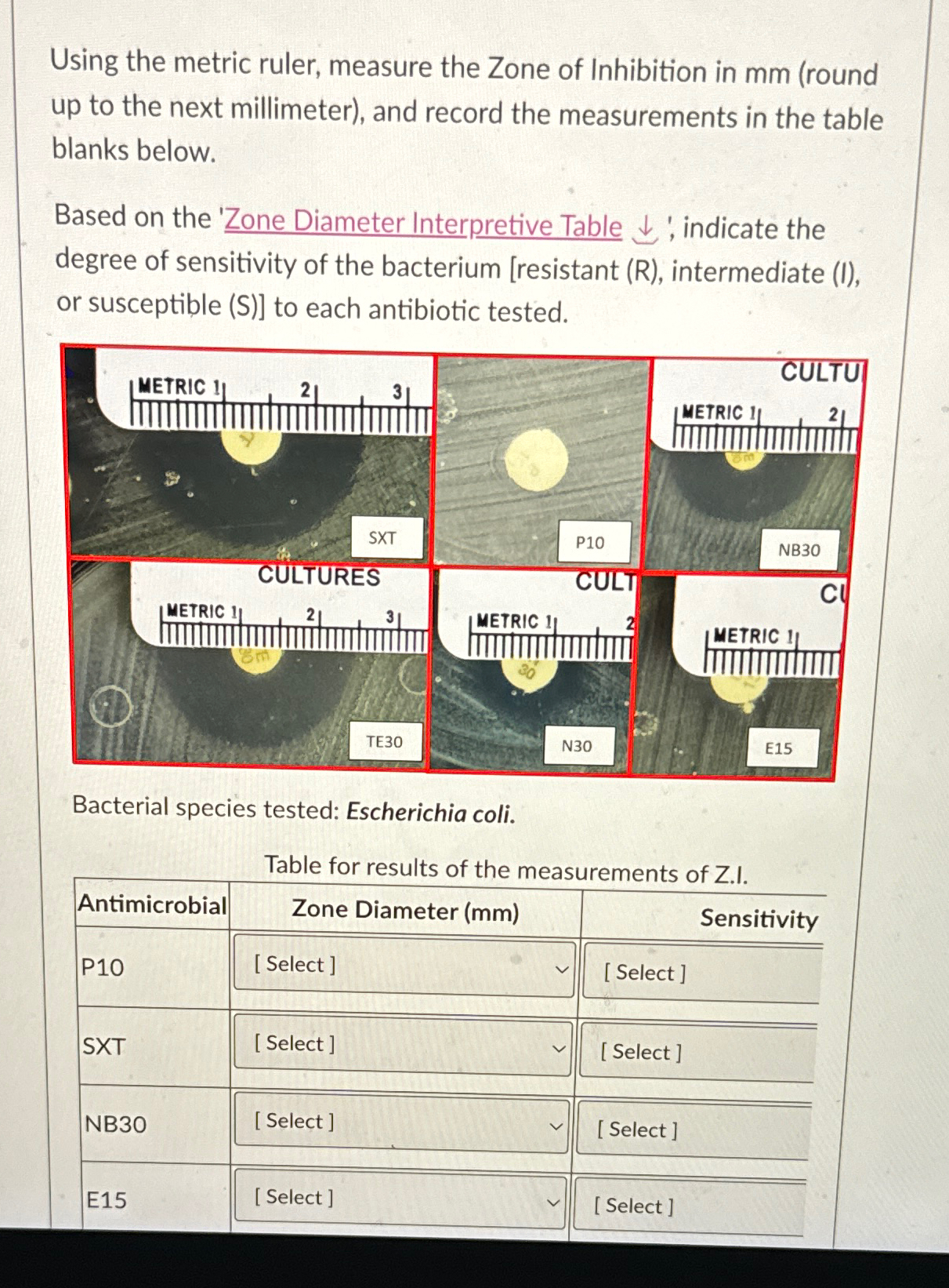 Using the metric ruler, measure the Zone of | Chegg.com
