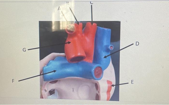 Solved identify the vessels | Chegg.com