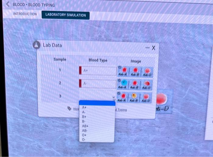 Solved BLOOD ⋅ BLOOD TYPING INTRODUCTION LABORATORY | Chegg.com