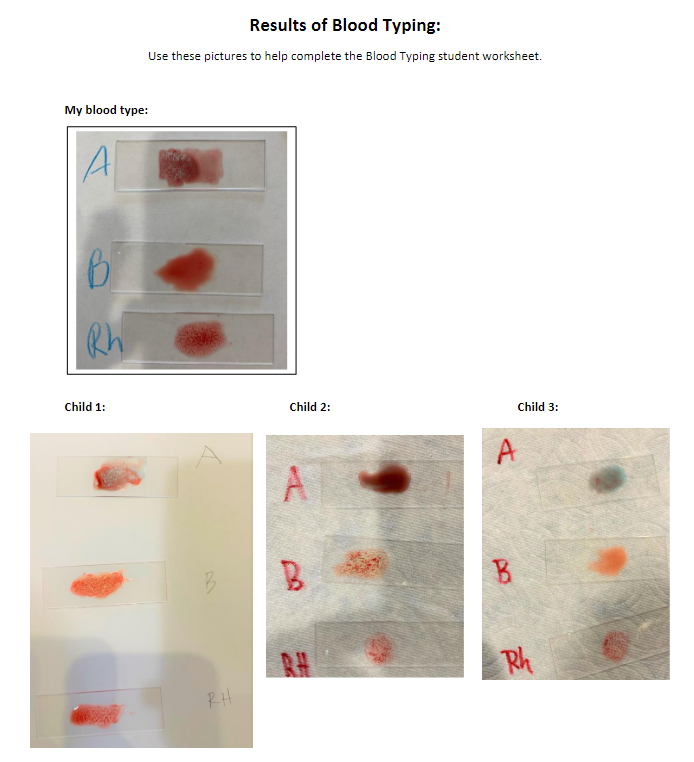Solved Blood Typing LabObjectives:Review ABO and Rh blood | Chegg.com