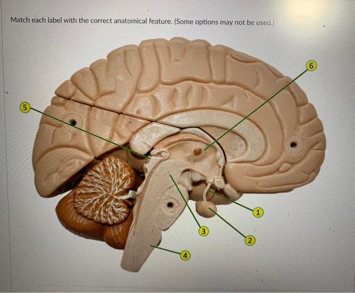 Solved options include:- inferior colliculus- thalamus- | Chegg.com