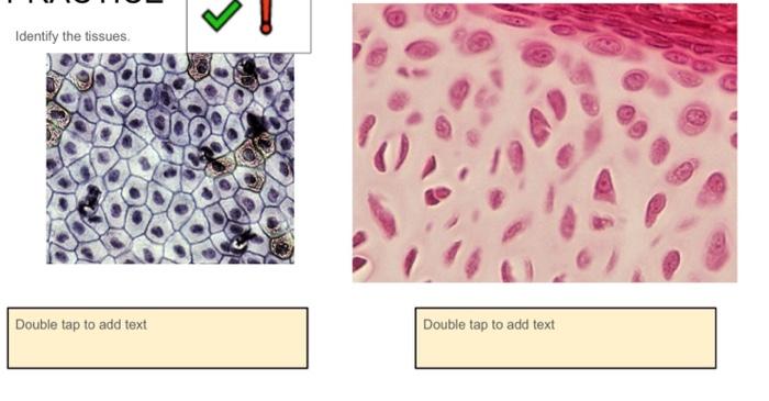 Solved 1 Identify The Two Tissue 2 Name The Cells Of Chegg
