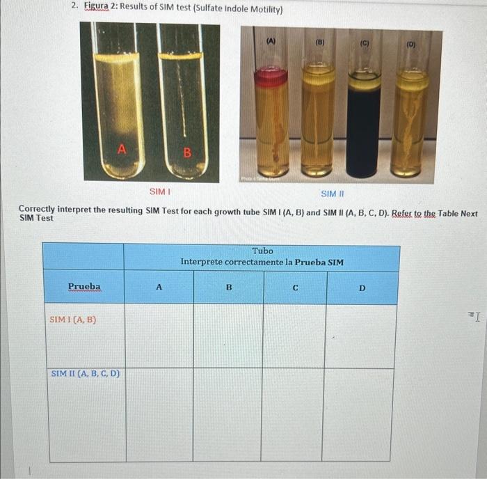 Solved 2. Figura 2: Results of SIM test (Sulfate Indole | Chegg.com