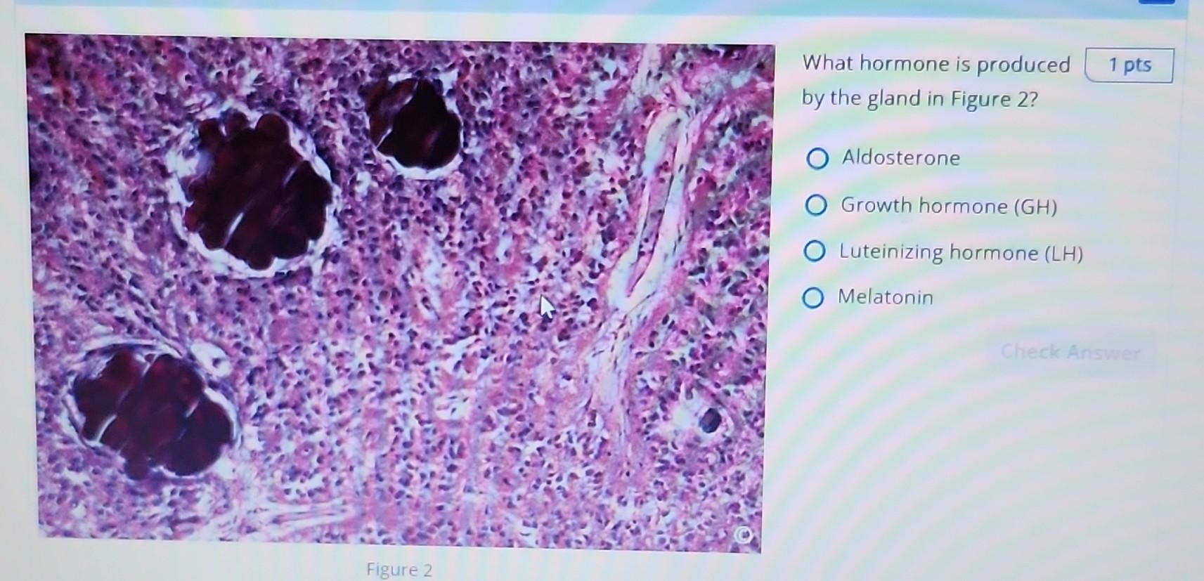 Solved What hormone is produced by the gland in Figure 2? | Chegg.com