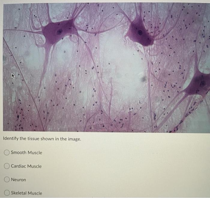 Solved Identify the tissue shown in the image. Smooth Muscle | Chegg.com