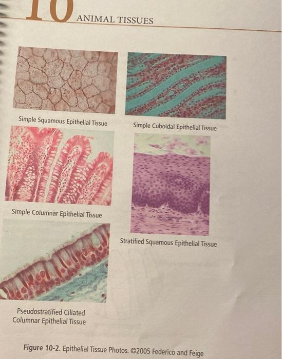 Solved ANIMAL TISSUES Simple Squamous Epithelial Tissue | Chegg.com