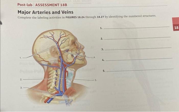 Solved Post-lab ASSESSMENT 18B Major Arteries and Veins | Chegg.com