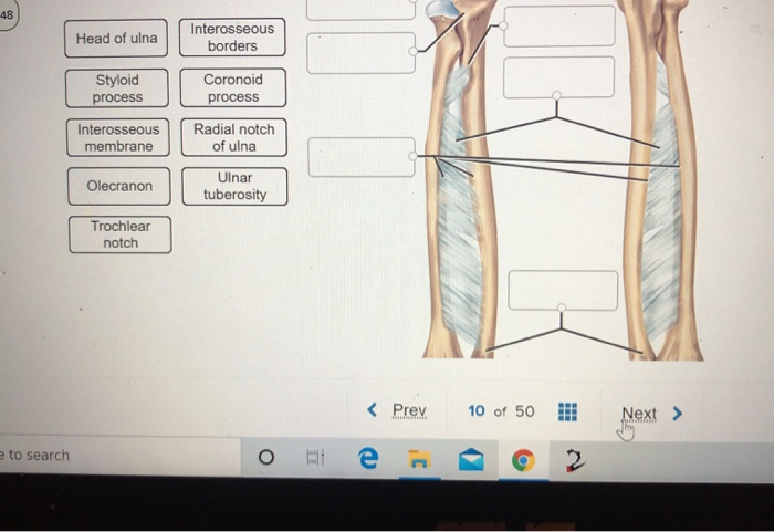 Solved 48 Head of ulna Interosseous borders Styloid process | Chegg.com
