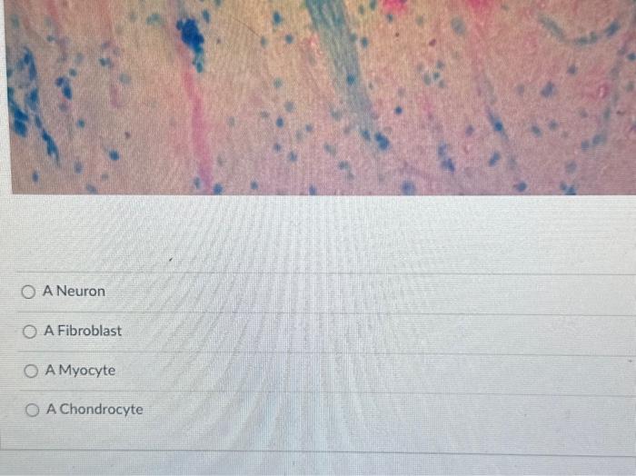 Solved The big blue cell in the middle of this slide is: A | Chegg.com