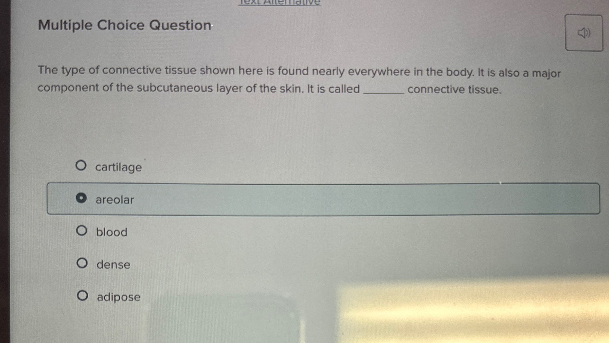 Solved Multiple Choice QuestionThe type of connective tissue | Chegg.com