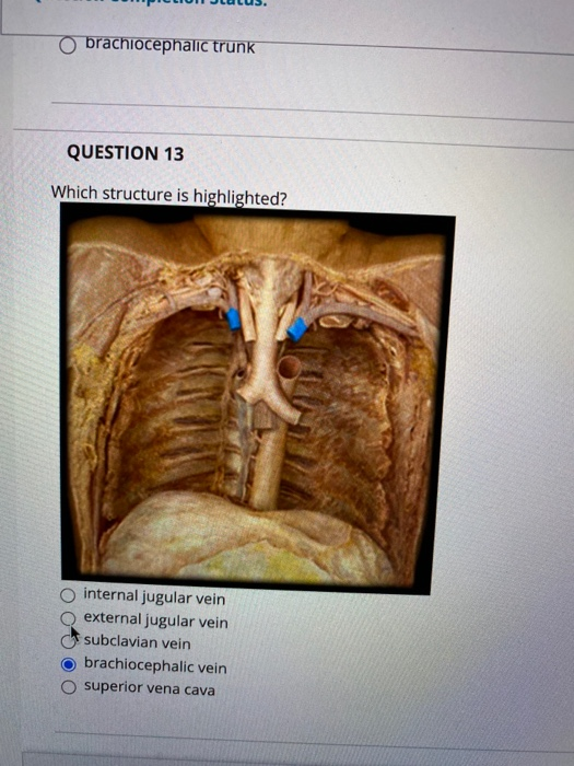 Solved QUESTION 19 Which structure is highlighted? right | Chegg.com