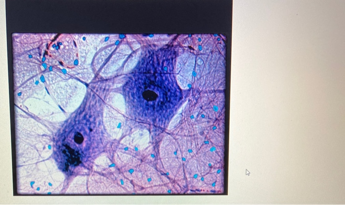 Solved स Multiple Choice Neuron Epithelial cells Neuroglio | Chegg.com