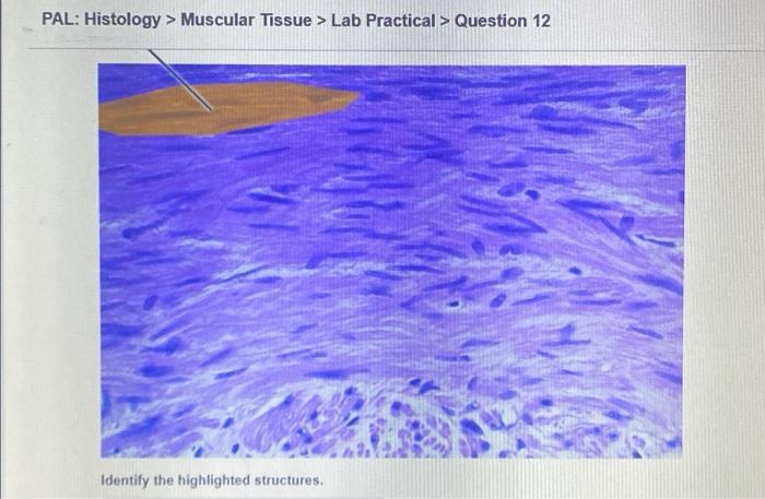 Solved PAL: Histology > Muscular Tissue > Lab Practical > | Chegg.com