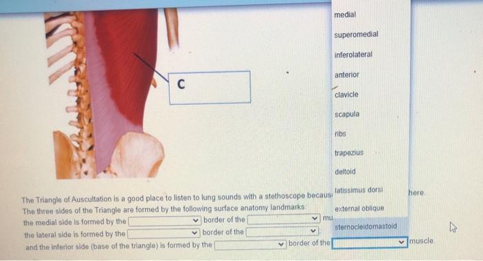 Solved A B Triangle of auscultation С medial superomedial | Chegg.com