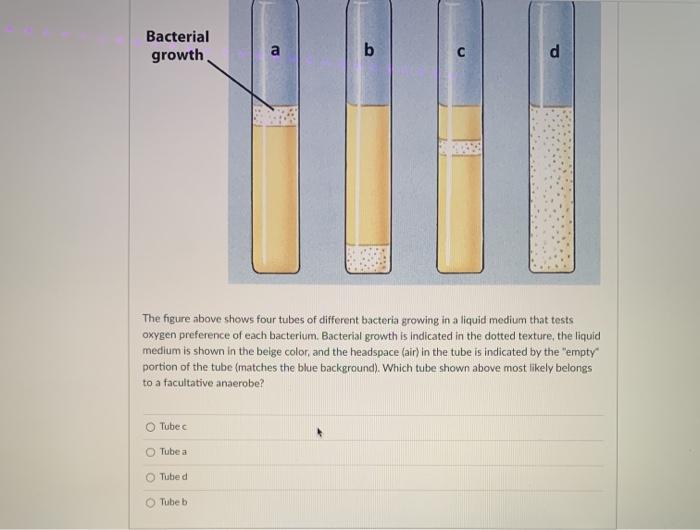 Solved Bacterial growth a b d The figure above shows four | Chegg.com