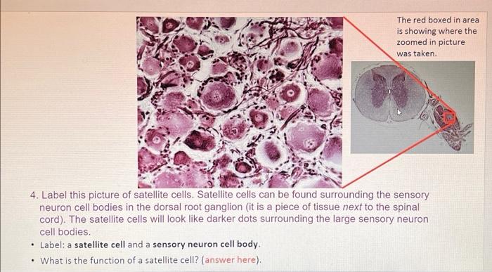 Solved 4. Label this picture of satellite cells. Satellite | Chegg.com