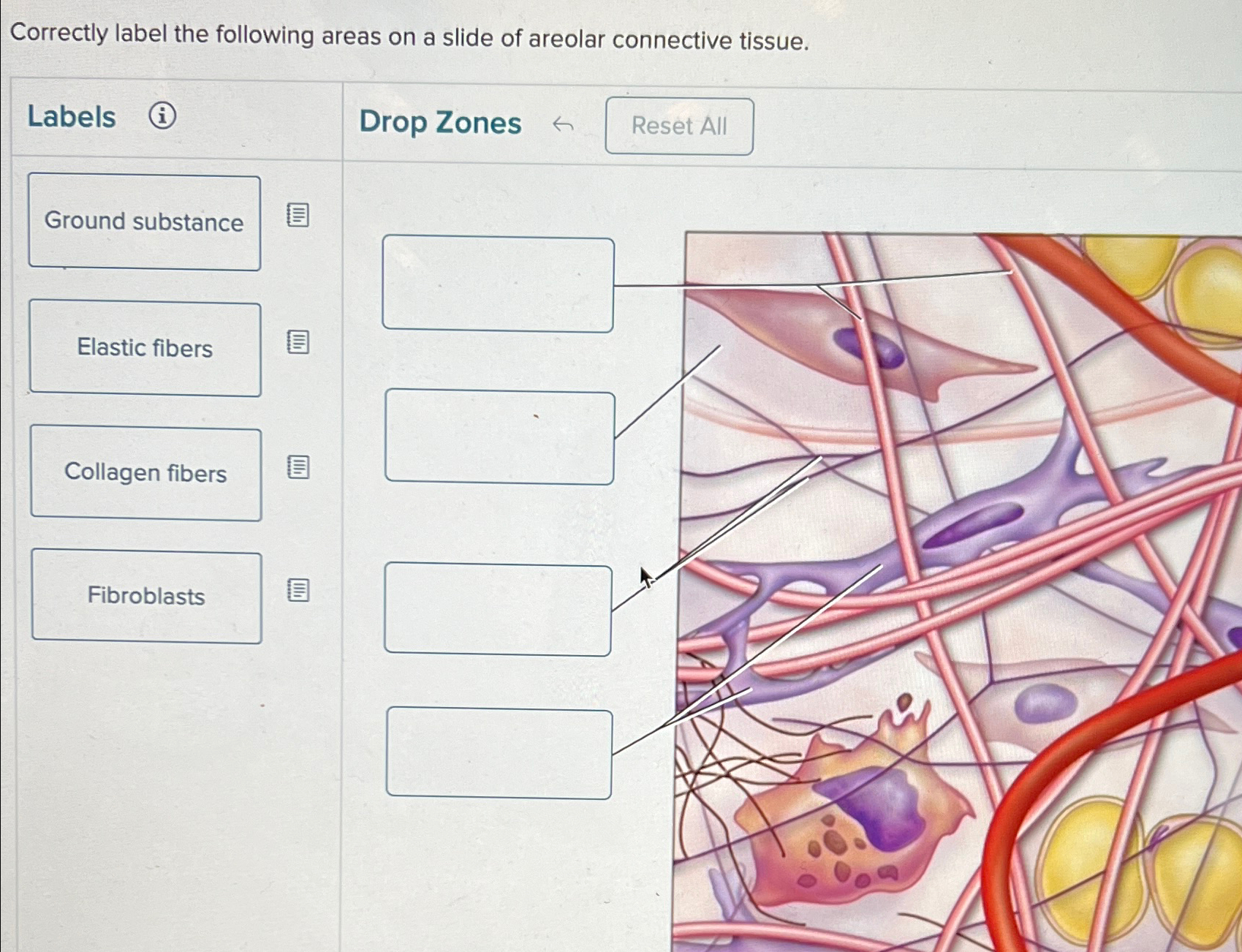 Solved Correctly label the following areas on a slide of | Chegg.com