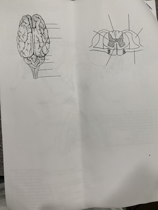 Solved label the parts of the brain and spinal cord of a pig | Chegg.com