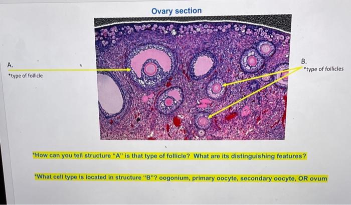 Solved A. B. "type of follicle "type of follicles "How can | Chegg.com