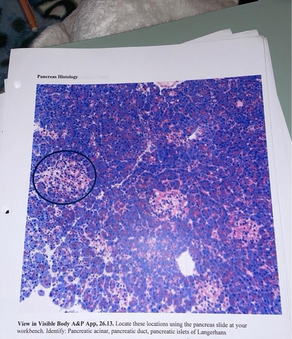 Solved Pancreas Histology View in Visible Body A&P App, | Chegg.com