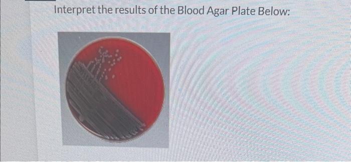 Solved Interpret the results of the Blood Agar Plate Below: | Chegg.com