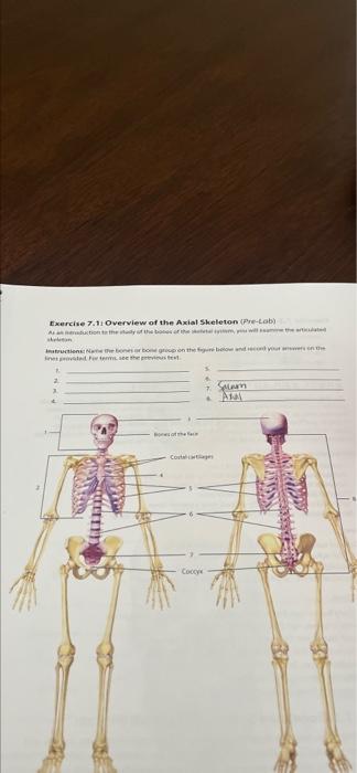 Solved 2 Exercise 7.1: Overview of the Axial Skeleton | Chegg.com