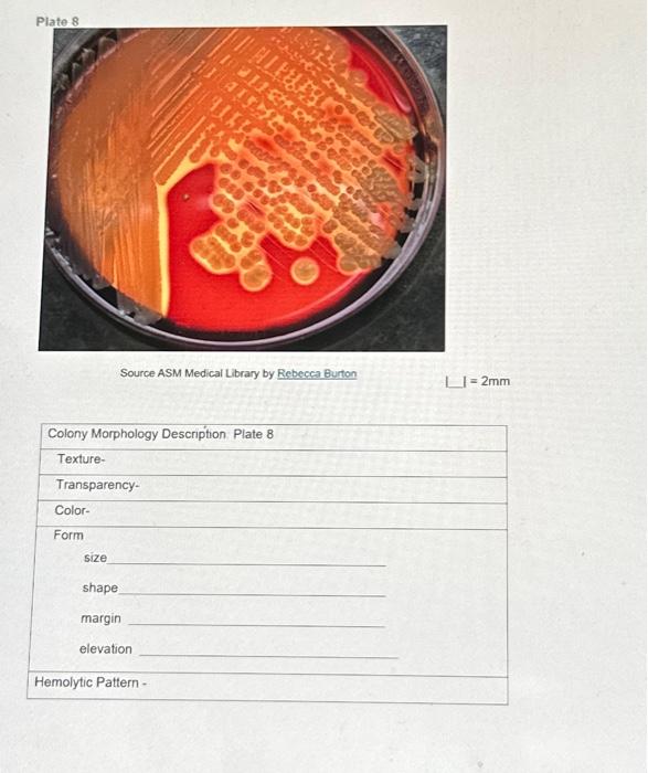 Solved Source ASM Medical Library by Rebecca Burton 1=2 mm | Chegg.com