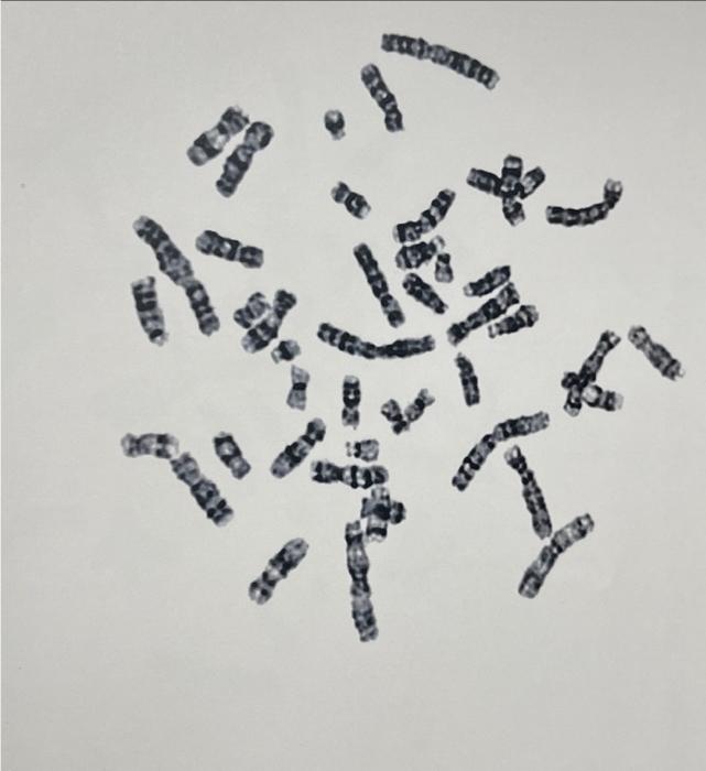 Solved need help karyotyping putting it in order | Chegg.com Solved need help karyotyping putting it in order | Chegg.com