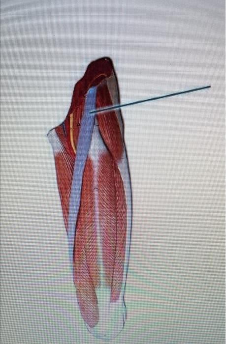 Solved identify the highlighted muscle | Chegg.com