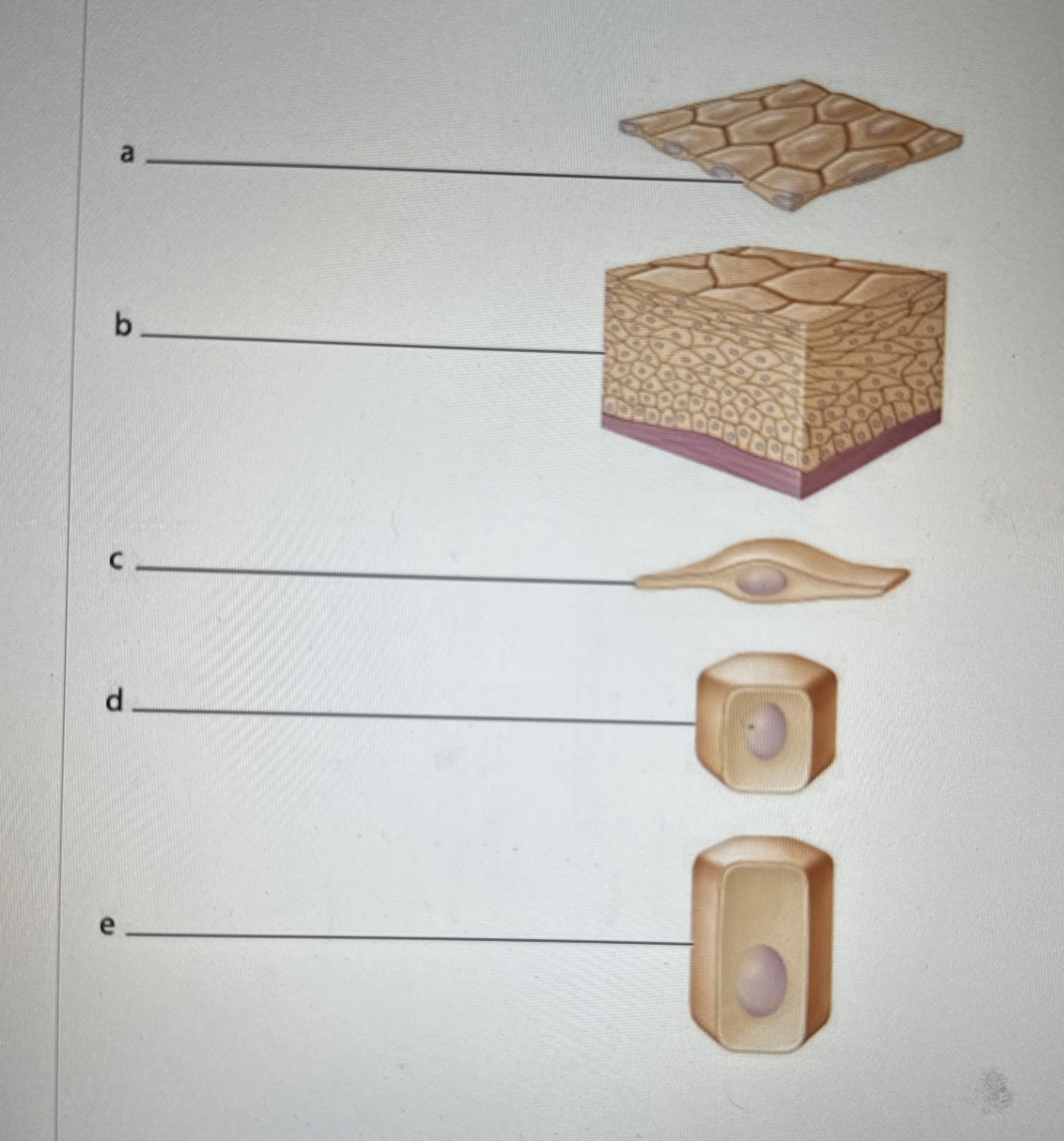 Solved Which best describes the cell labeled "d"?A. | Chegg.com