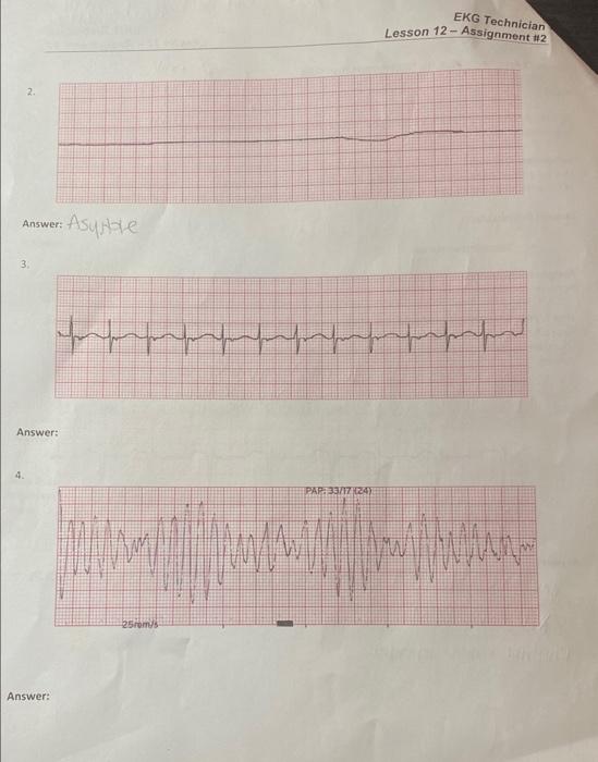 Solved Lesson 12 Assignment #2: Basic EKG Interpretation | Chegg.com