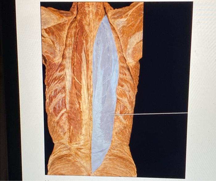 Solved Identify the highlighted muscles. LT-VA 16: | Chegg.com