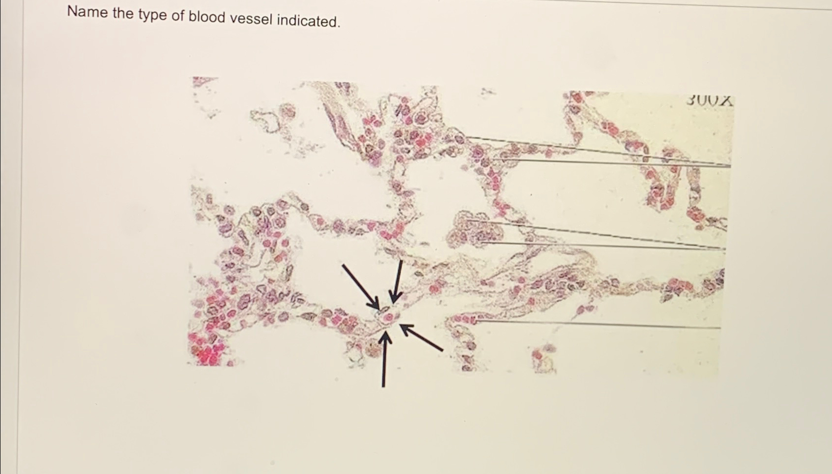 Solved Name the type of blood vessel indicated. | Chegg.com