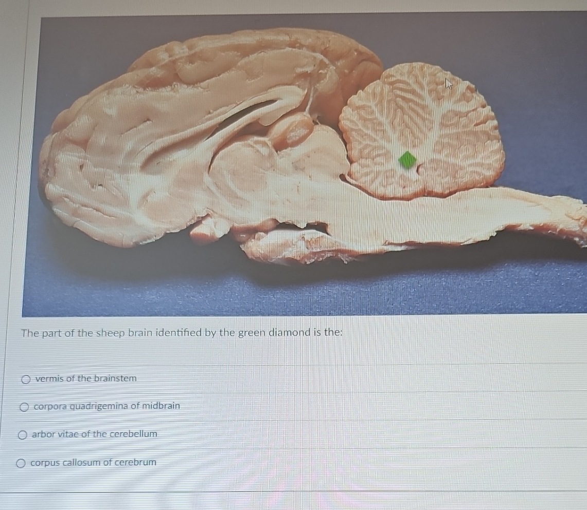 Solved The part of the sheep brain identified by the green | Chegg.com