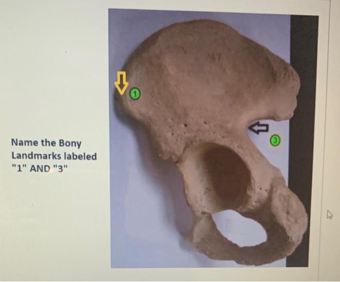 Solved (A) Id the Bony Landmark labeled "1" in Green. (B) | Chegg.com