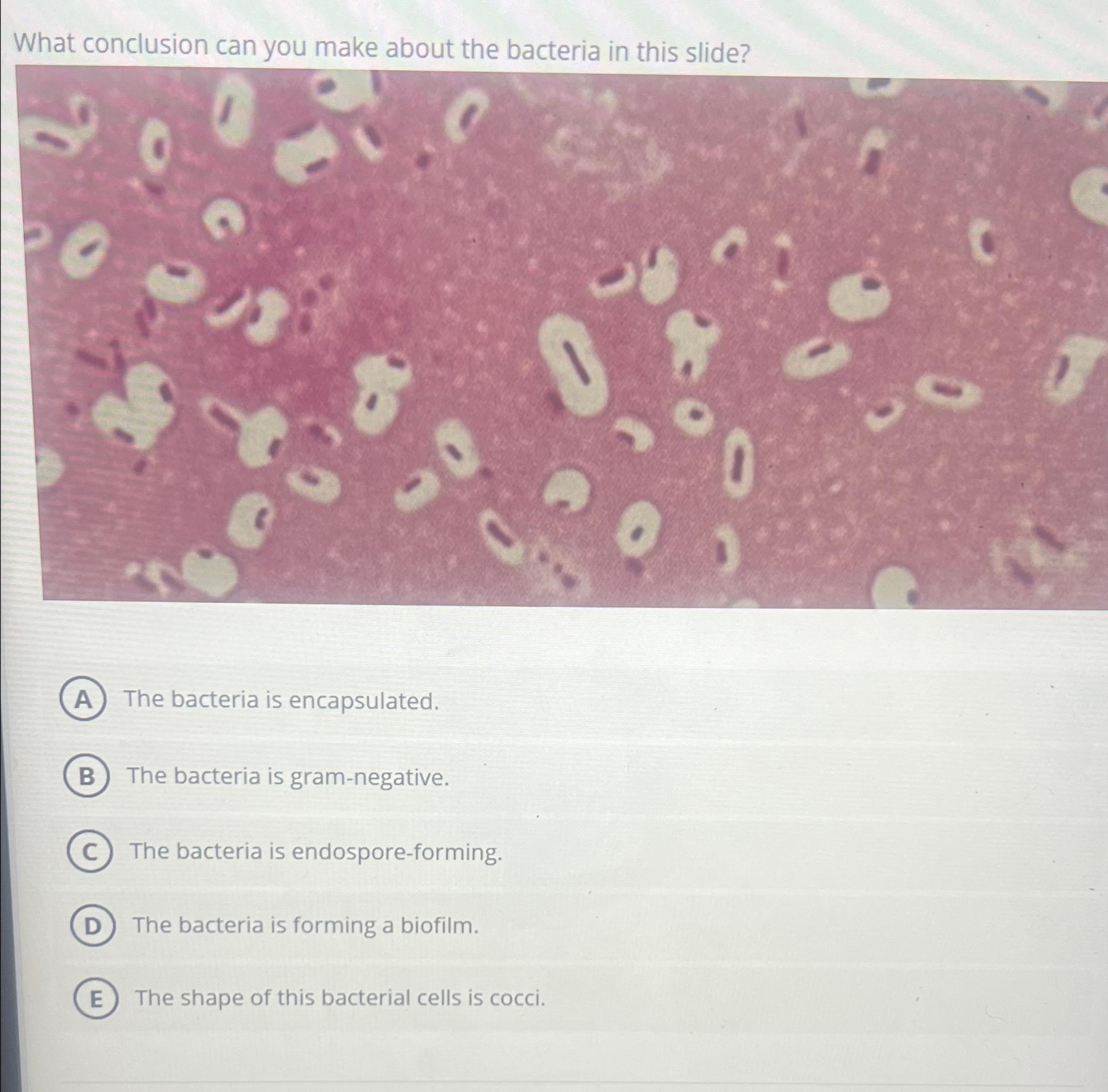Solved What conclusion can you make about the bacteria in | Chegg.com