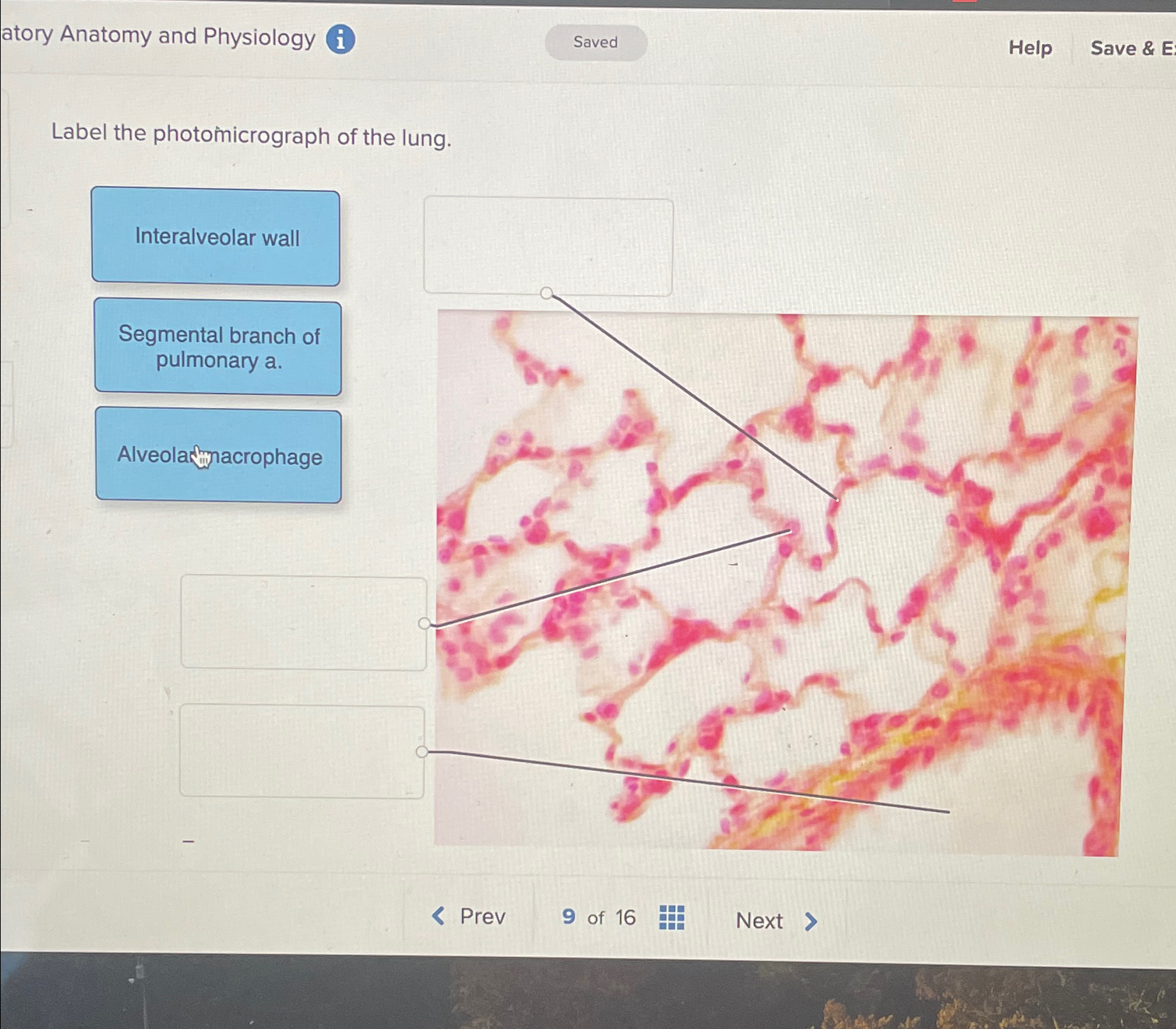 Solved atory Anatomy and Physiology(i)HelpSave &Label the | Chegg.com