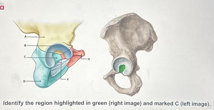 Solved Identify the surface highlighted in green and | Chegg.com