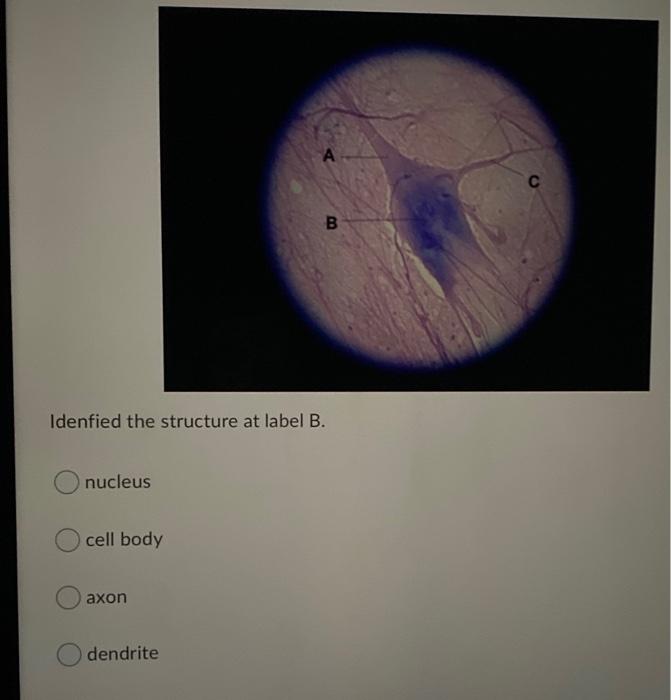 Solved Which structure is highlighted? ventral rootlets | Chegg.com